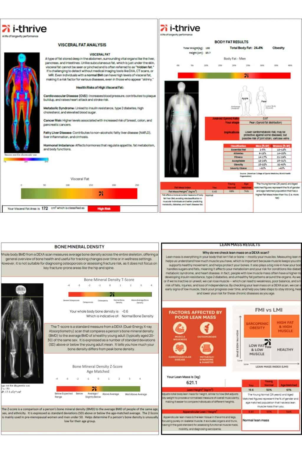 DEXA Body Composition | Visceral Fat, Lean Mass | i-Thrive